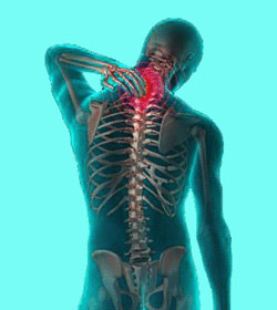 arthritis-neck-pain-treatment-51 - Neck Pain
