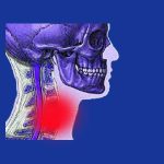 Globus Sensation Neck Pain - Neck Pain