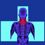 Mechanical Neck Pain - Neck Pain